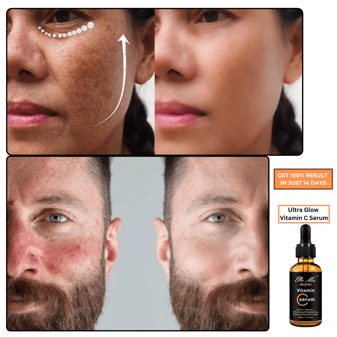 SHO-SC Ultra Glow Vitamin C Serum with Korean Anti-Aging Formula🌿 ...